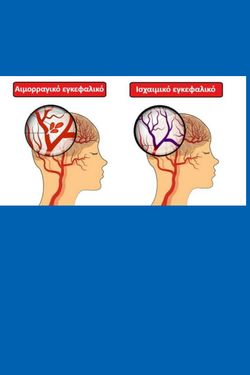 Book Creator | ΤΥΠΟΙ ΑΓΓΕΙΑΚΩΝ ΕΓΚΕΦΑΛΙΚΩΝ ΕΠΕΙΣΟΔΕΙΩΝ (Α.Ε.Ε))