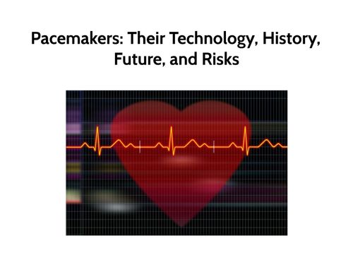 Book Creator | Pacemakers